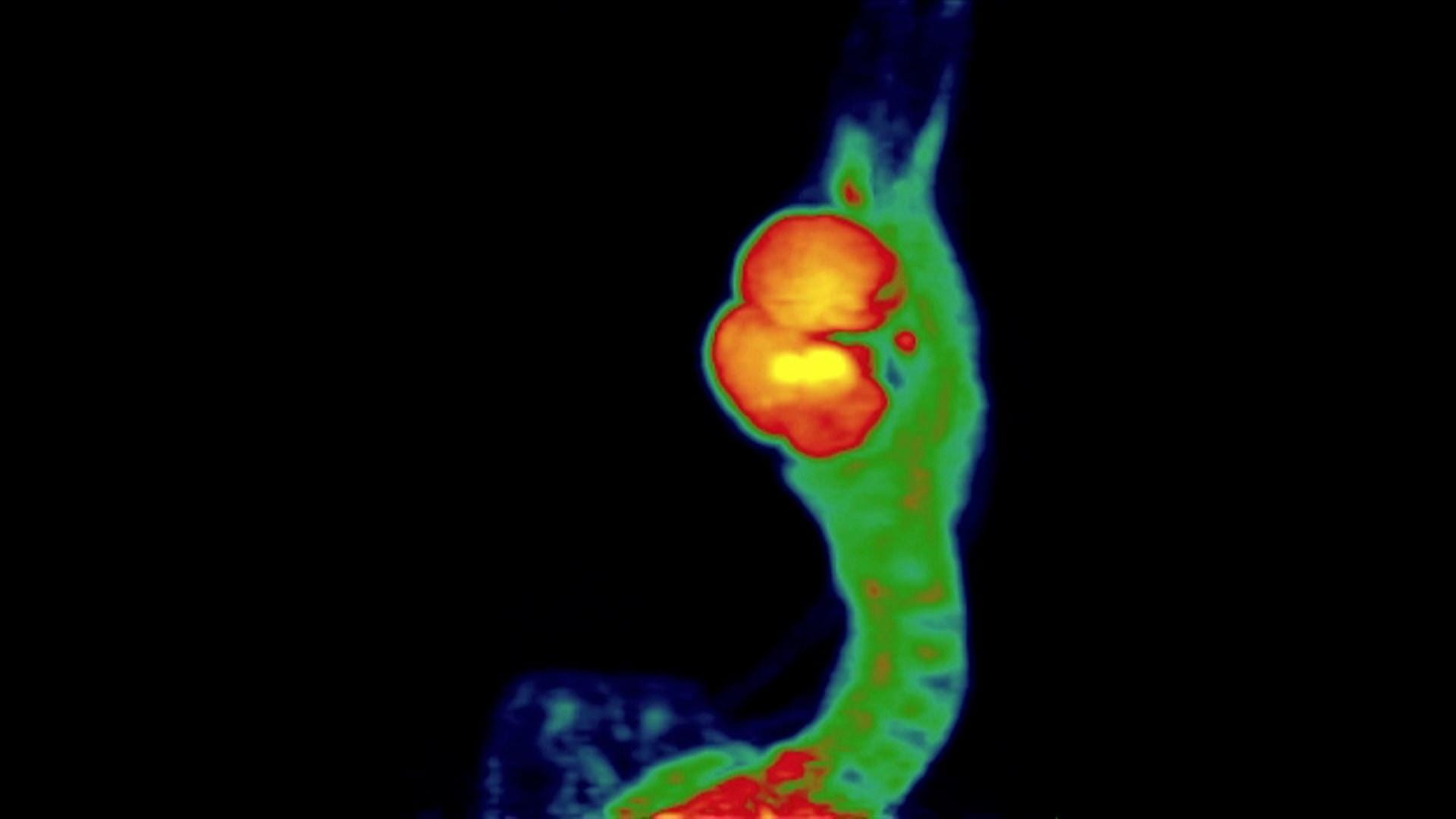 The Surprising Power of a Bird Brain | Cascade PBS